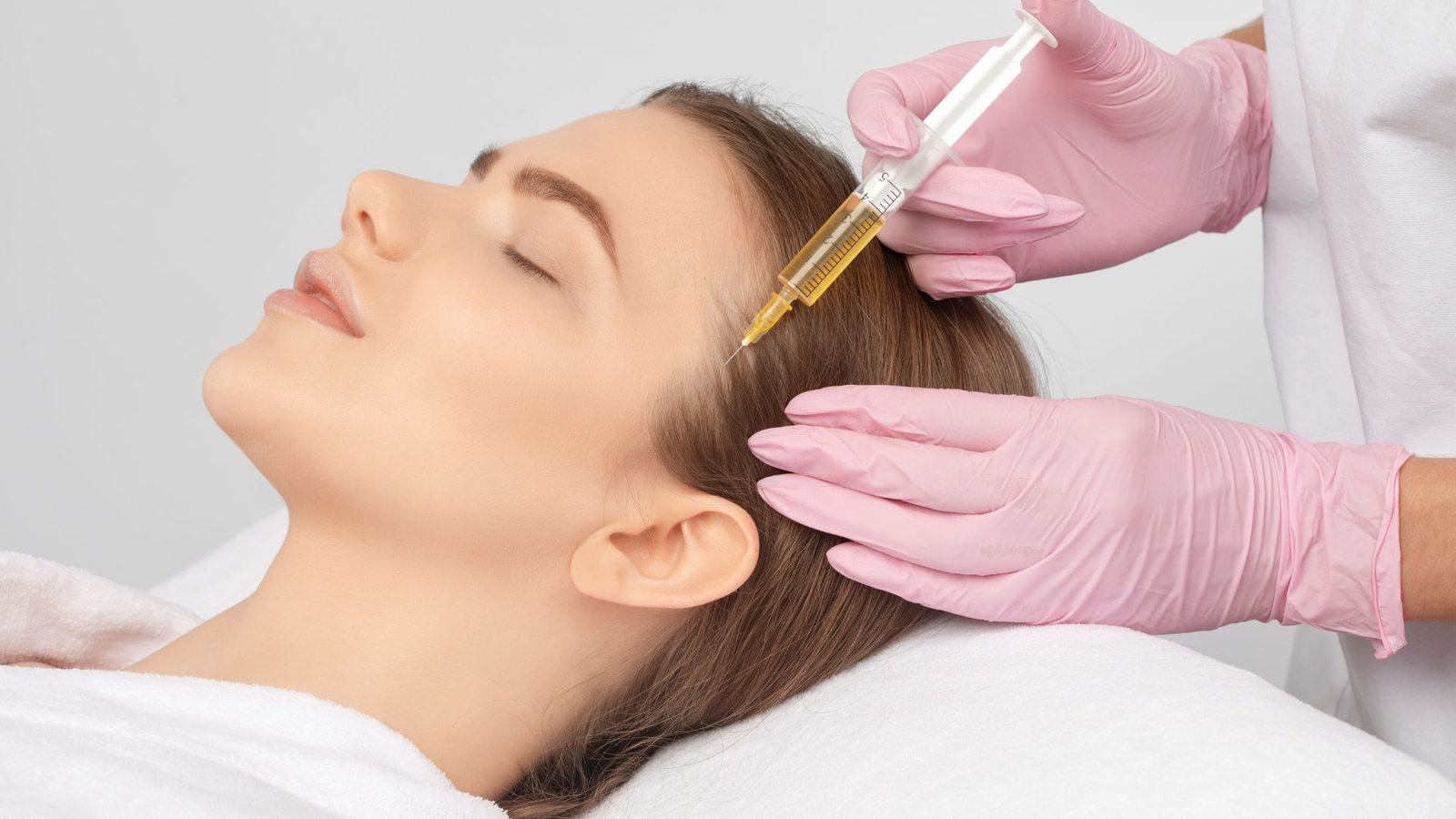 PRP Hair Restoration Oakville, Ontario | Fyxson Medical Aesthetics